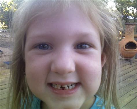 Snaggle Teeth Quotes Quotesgram