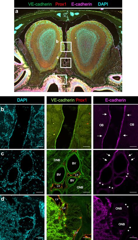 The Arachnoid Is Interrupted Between Olfactory Nerve Bundles And Download Scientific Diagram