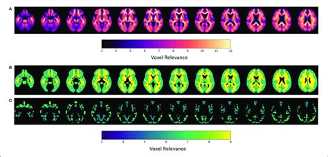 ε Lrp Relevance Maps Indicating The Contribution Of Each Voxel And Download Scientific