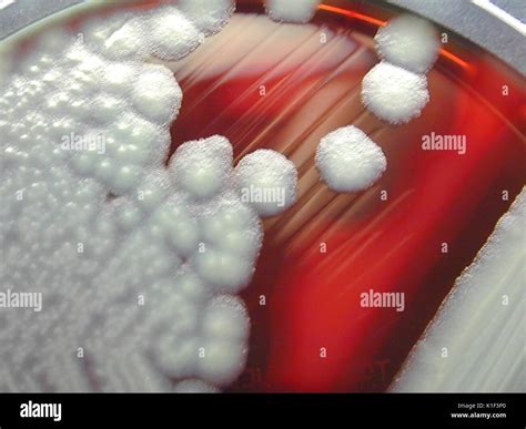 Bacillus Cereus Agar