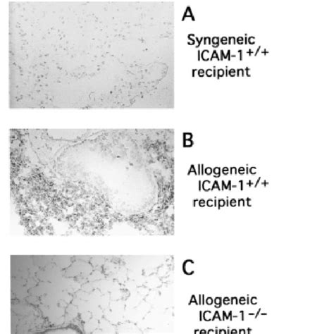 Intercellular Adhesion Molecule 1 Icam 1 Recipients Download
