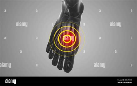 Extensor Digitorum Longus Tendon Discomfort That Trigger Pain Stock Photo Alamy