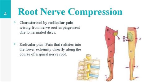 Approach To The Patient With Back Pain Presented