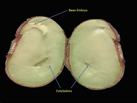Bean Seed Embryo At Tiffany Mora Blog