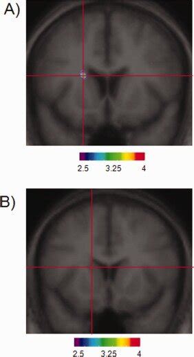 Last Experimental Trial Of The Encoding Phase Stage 1 Contrasted Download Scientific Diagram