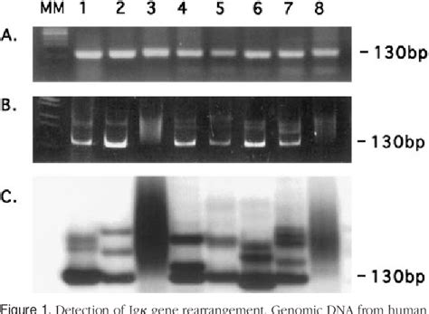 Figure 1 From Technical Advance Detection Of Immunoglobulin K Light