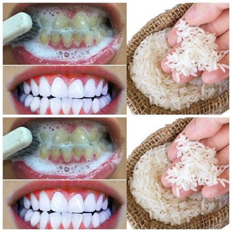 Whiten Your Teeth In Just 1 Minute A Quick And Natural Solution