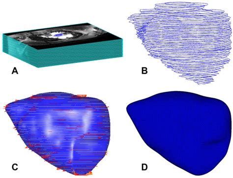 Figure 1 From Left Atrium Surface Mesh Reconstruction From Cardiac Mri