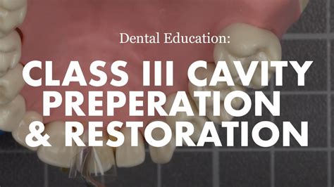 Class Iii Cavity Preparation And Restoration Youtube