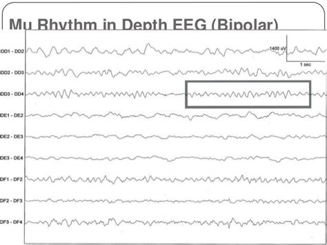 Mu Rhythm