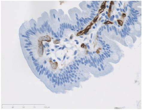 Ulex Europaeus Agglutinin Uea Staining A Patient C4 Non Cd