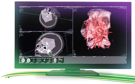 Home Visage Imaging