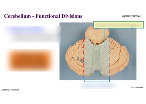 Diagram Of 2 Of 3 Functional Divisions Of Cerebellum Quizlet