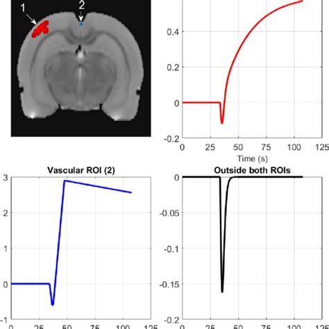 Cartesian Gradient Echo Pulse Sequence Full Data Ifft Reconstructions Download Scientific