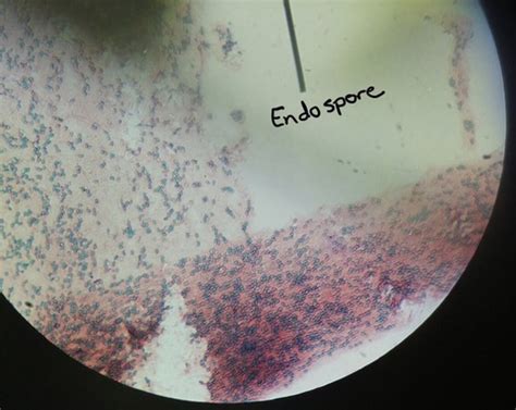 Microbio Lab Spore Staining Flashcards Quizlet