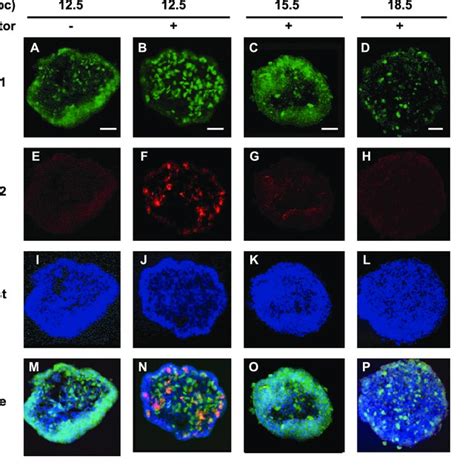 Male And Female Pathways Of Sex Differentiation In Mouse Fetal Germ