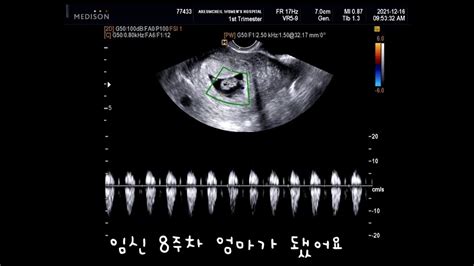 신혼부부 일상 Vlog 행복한 생일2명에서 3명이 된 우리 가족임밍아웃8주차 엄마가 됐어요 Youtube