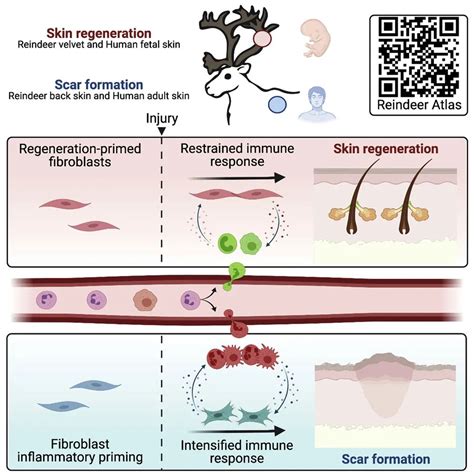 If 66 85丨成纤维细胞炎症启动决定驯鹿皮肤再生与皮肤纤维化修复 单细胞测序网