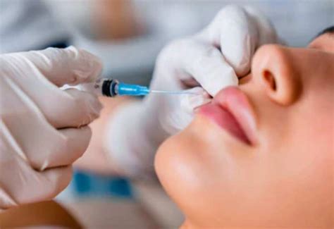 How To Get Cupids Bow Lips Diaminyaesthetics