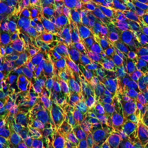 How Cells Initially Sense And Adhere To Fibrillar Extracellular Matrices Biophysics Group