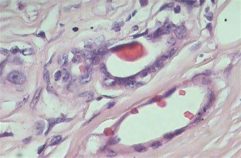 Benign Classification Dataset By Trial