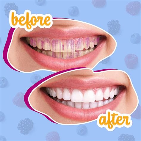 Plaque Disclosing Tablets Dental Disclosing Tablets A Teeth Coloring