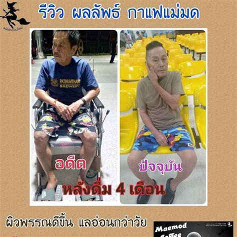 มนตราเซรั่ม มนตราเซรั่ม หน้าเด้ง ลดริ้วรอย สยบสิว สลายฝ้า