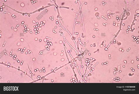 Saccharomyces Cerevisiae Microscope Slide Fungal Microscopy