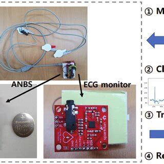 PDF TinyML Based Classification In An ECG Monitoring Embedded System
