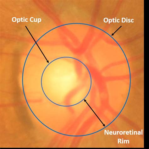 Block Diagram Of The Proposed Optic Disc And Cup Segmentation System Download Scientific