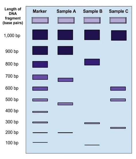 Gel Electrophoresis Principle And Application ~ Biotechfront