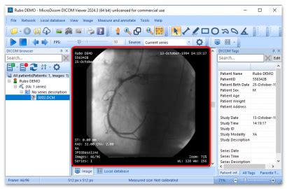 Чем открыть формат DCM