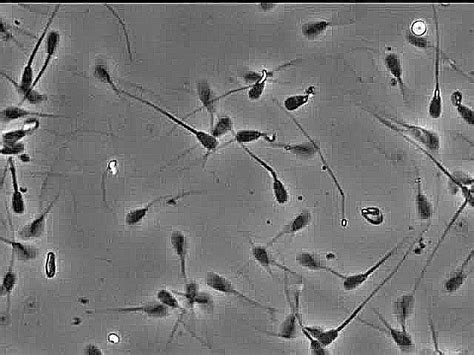 Spermbull Instance Segmentation Dataset By Projects