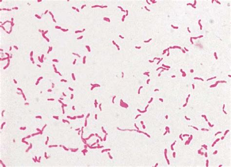 霍乱弧菌 实验诊断学图谱