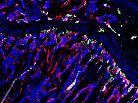 Thunder Imager Tissue Applications Products Leica Microsystems