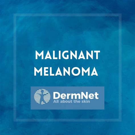 Dermnet On Linkedin Malignant Melanoma Is A Potentially Very Serious Skin Cancer In Which…