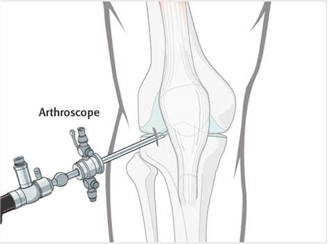 Home — Sydney Orthopaedic Consultants Dr George Konidaris Orthopaedic