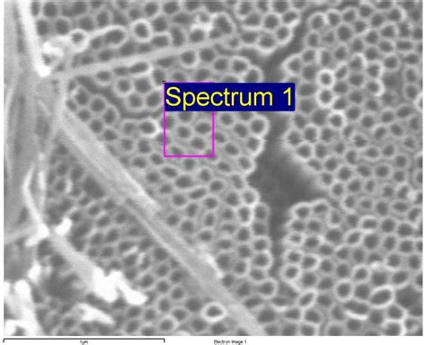 Scanning Electron Micrographs Showing The Microstructure Of A Download Scientific Diagram