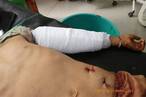 ကျိုက်ထိုမြို့နယ်တွင် စစ်ကောင်စီ လက်နက်ကြီးကျသဖြင့် မိသားစု ၆ ဦး ဒဏ်ရာရ