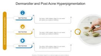 Dermaroller And Post Acne Hyperpigmentation Ppt Powerpoint Cpp PPT Sample