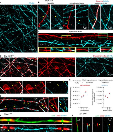 Score Microscopy For Label Free Myelin Imaging A In Vivo Image Using