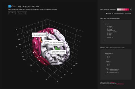 Mri Reconstruction Python · Issue 24 · Plotlydash Sample Apps · Github