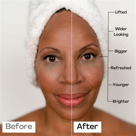 Eyelid Lifting Strips S 64 Pcs King Soopers