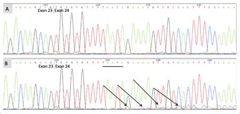 A Shows A Healthy Control Whereas The Sequencing Of Exon In The Download Scientific