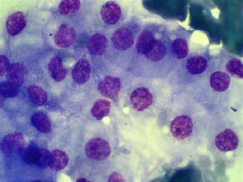Cytology Of Salivary Gland Cat Groups Of Glandular Tissue With Acinic