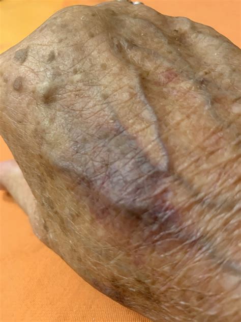 Quest Diagnostics 1701 N Lombard St Suite 106 Oxnard Ca Hours