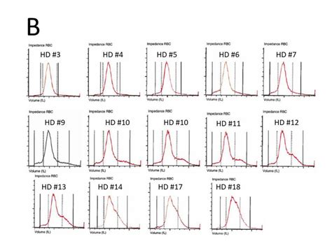 Ttp Rbc Histogram Over Time