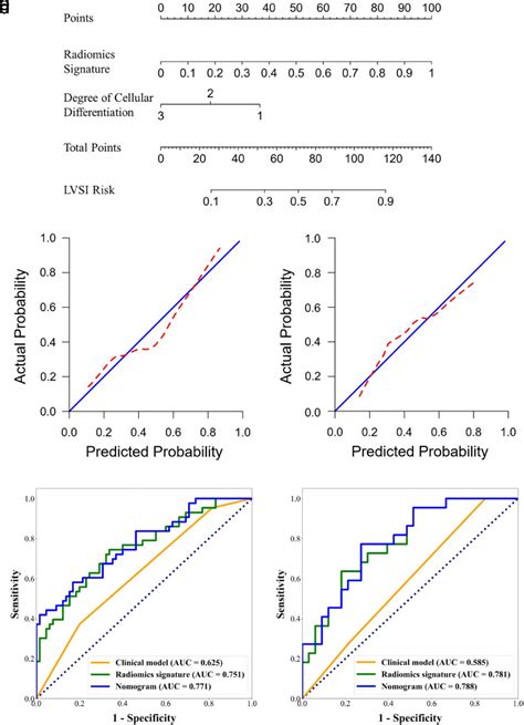 Multi Parametric Mri Based Peritumoral Radiomics On Prediction Of Lymph Vascular Space Invasion