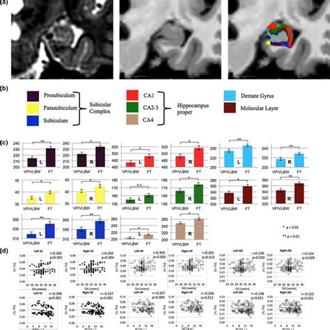 A Hippocampus Subfield Segmentation Exemplary Hippocampus Subfield Download Scientific