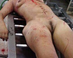 Vagina Autopsy GoreCenter